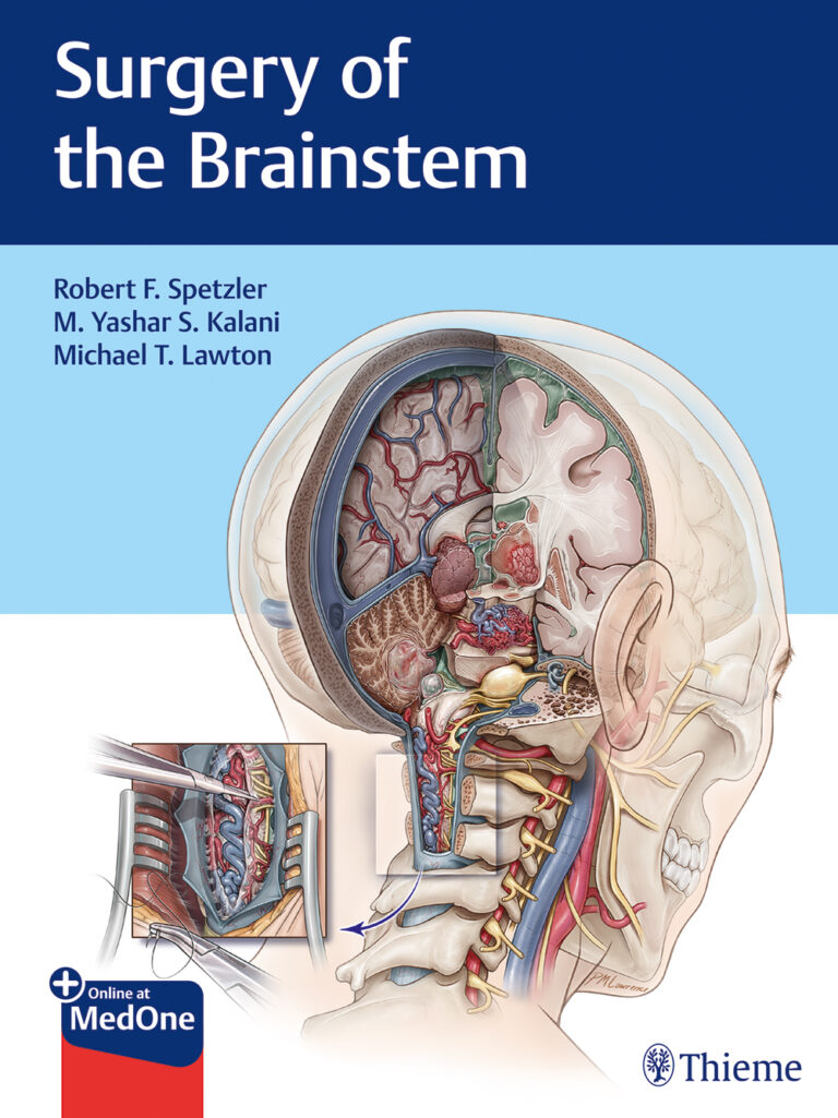 Best Books for Neurosurgery - Thieme UK