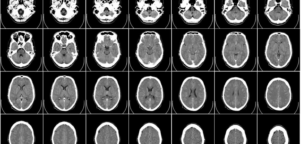 Embracing Neurodiversity - Yale University Press